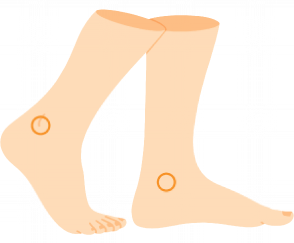 A Skeptics Guide to Acupuncture and Sleep: What’s the Science?