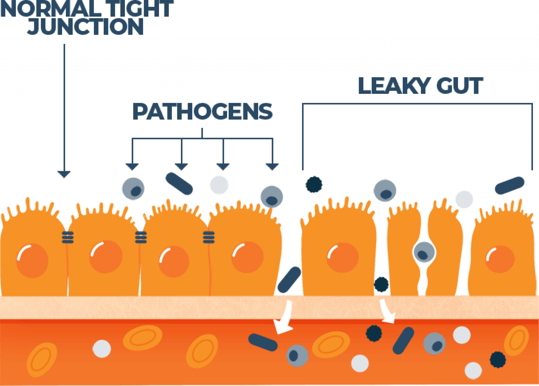 Probiotics and Sleep: Ways Your Gut Health is Keeping You Up